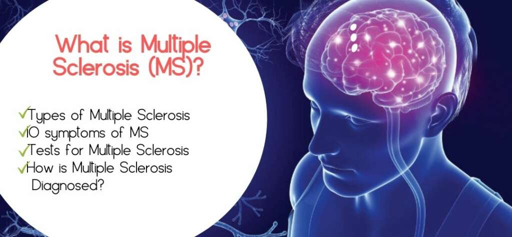 What is Multiple Sclerosis (MS) | Types of Multiple Sclerosis